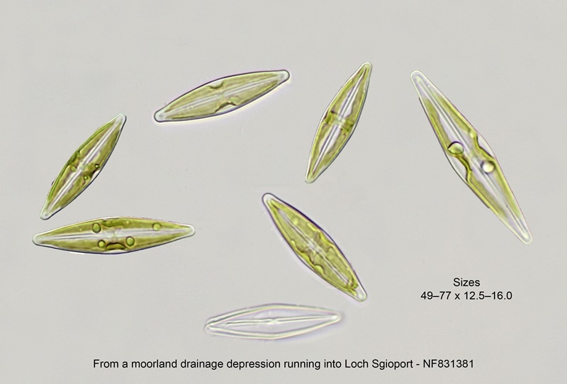 Hingley, M. (1993) Microscopic Life in Sphagnum